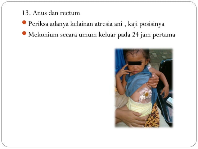 Pemeriksaan fisik bayi baru lahir | PPT