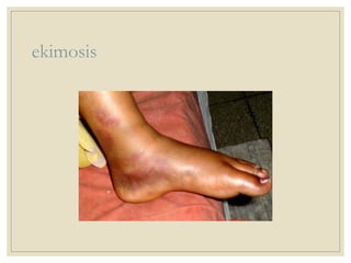 pemeriksaan fisik diagnostik kulit pada dermatologi | PPTX