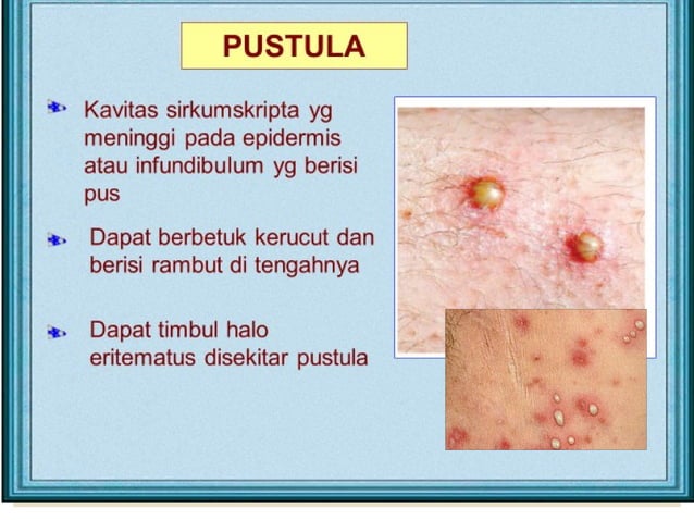 pemeriksaan fisik diagnostik kulit pada dermatologi | PPT