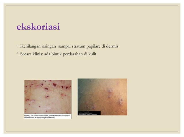 pemeriksaan fisik diagnostik kulit pada dermatologi | PPT