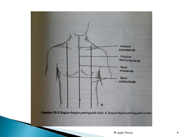 Pemeriksaan fisik pada toraks dan paru paru | PPT