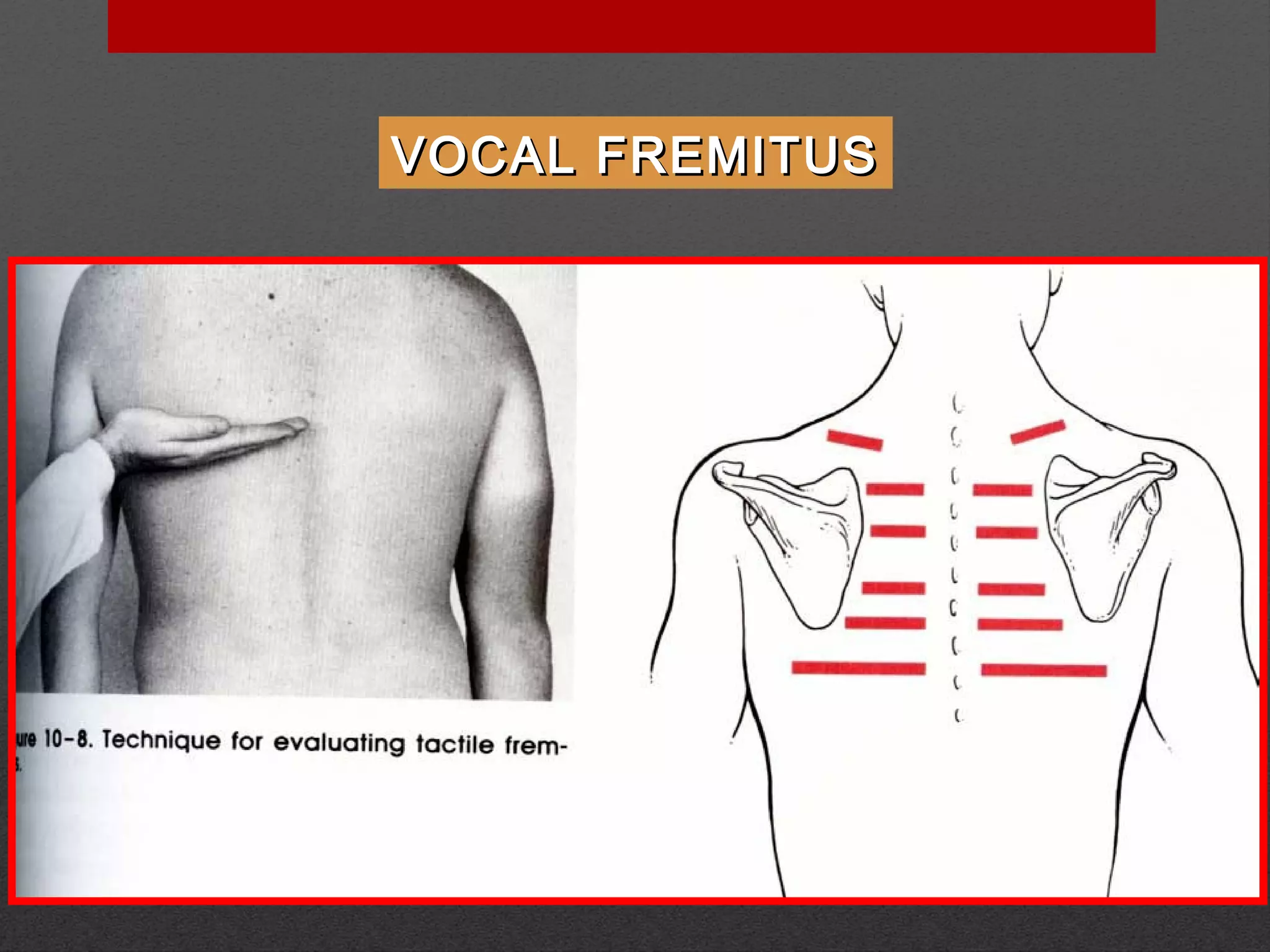 PEMERIKSAAN FIZIKAL SISTEM SALURAN PERNAFASAN | PPT