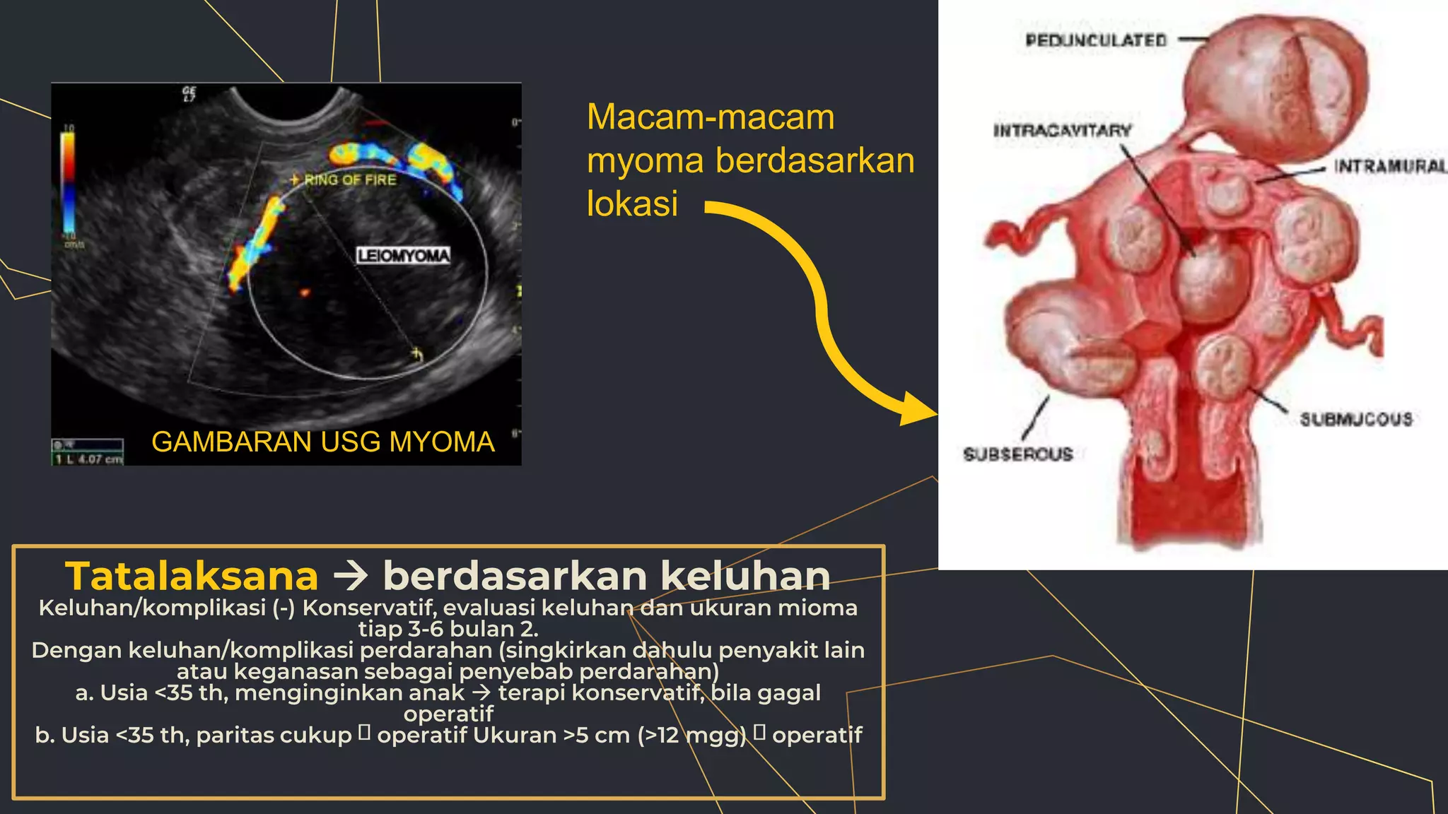 Pemeriksaan ginekologi | PPTX