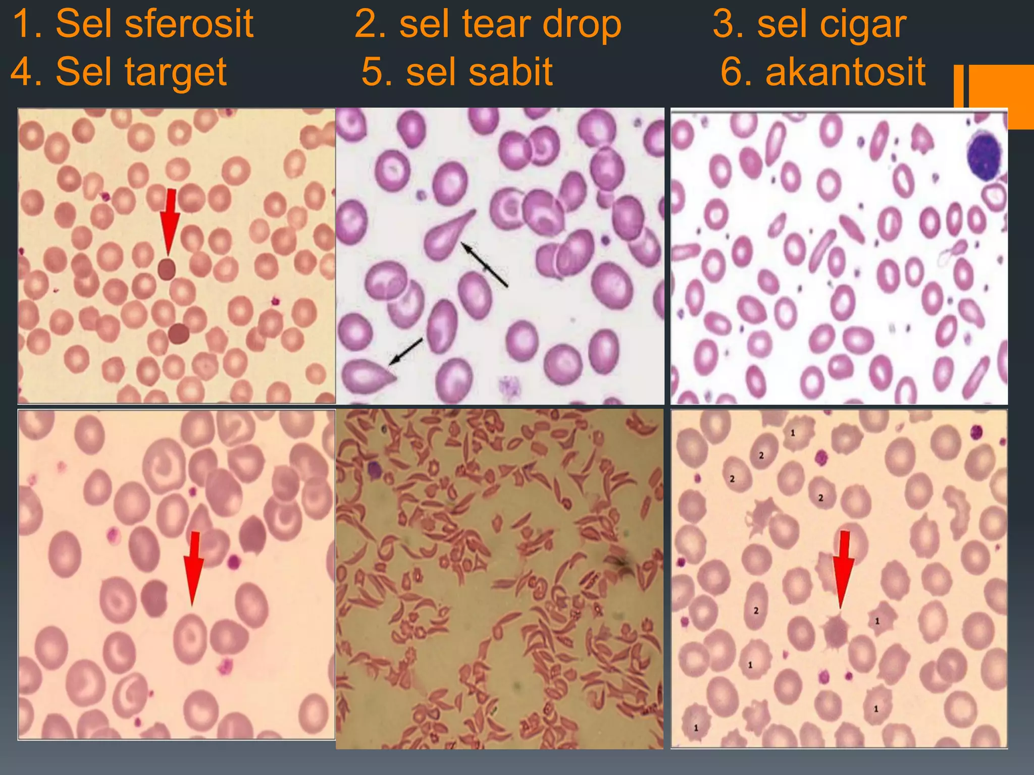 Pemeriksaan hematologi | PDF