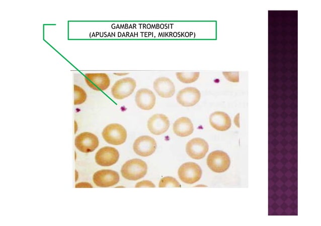 Pemeriksaan hematologi (darah rutin) | PDF