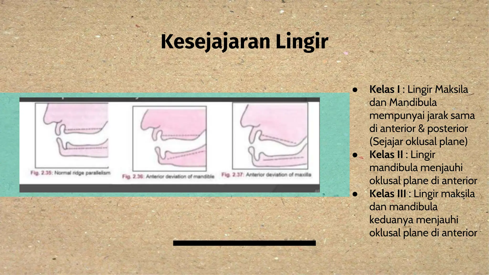 pemeriksaan klinis di bidang prostodonti.pptx