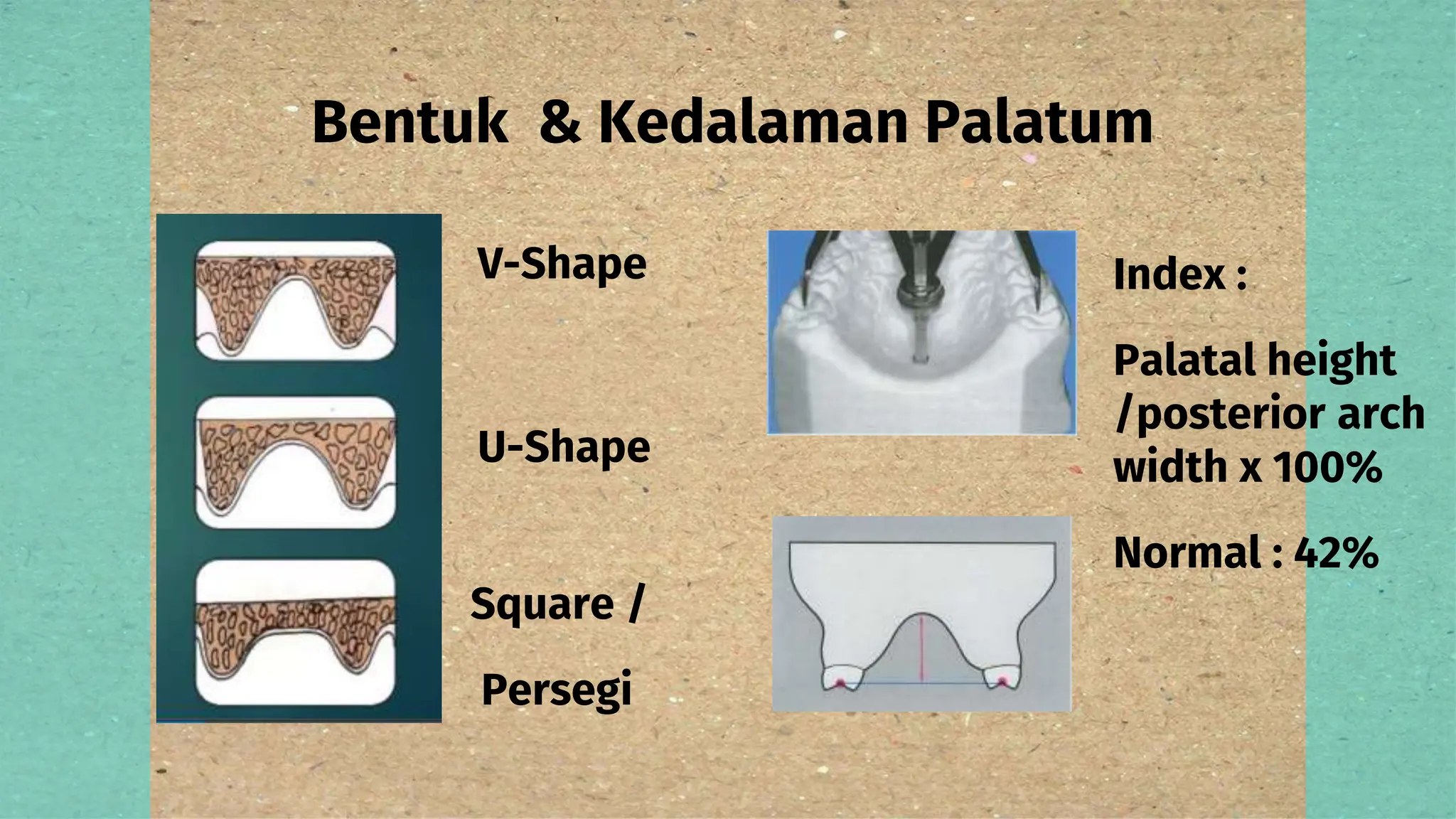 pemeriksaan klinis di bidang prostodonti.pptx