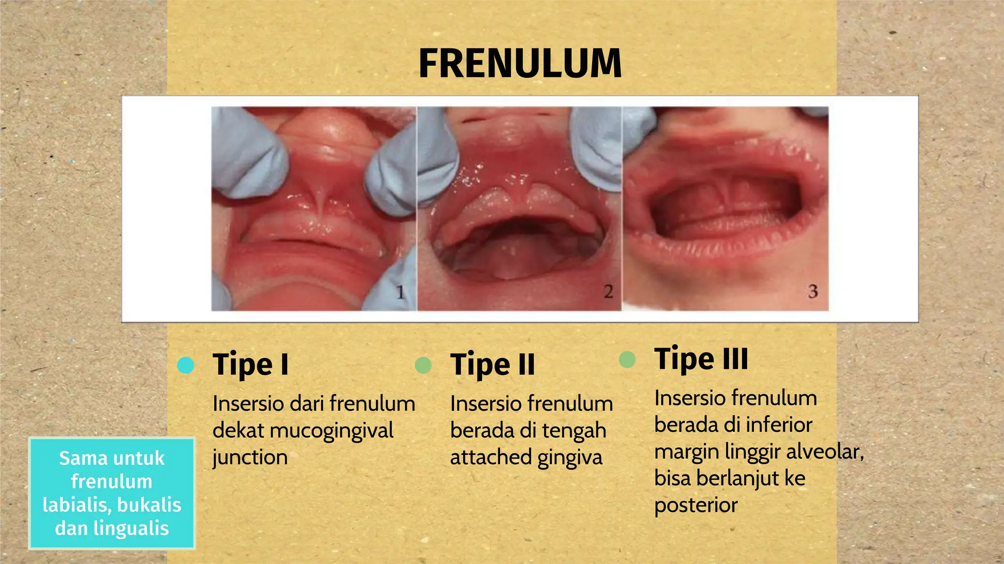 pemeriksaan klinis di bidang prostodonti.pptx