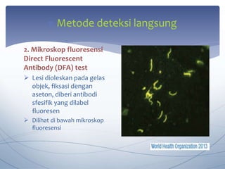 Pemeriksaan laboratorium sifilis (1) (1).pptx
