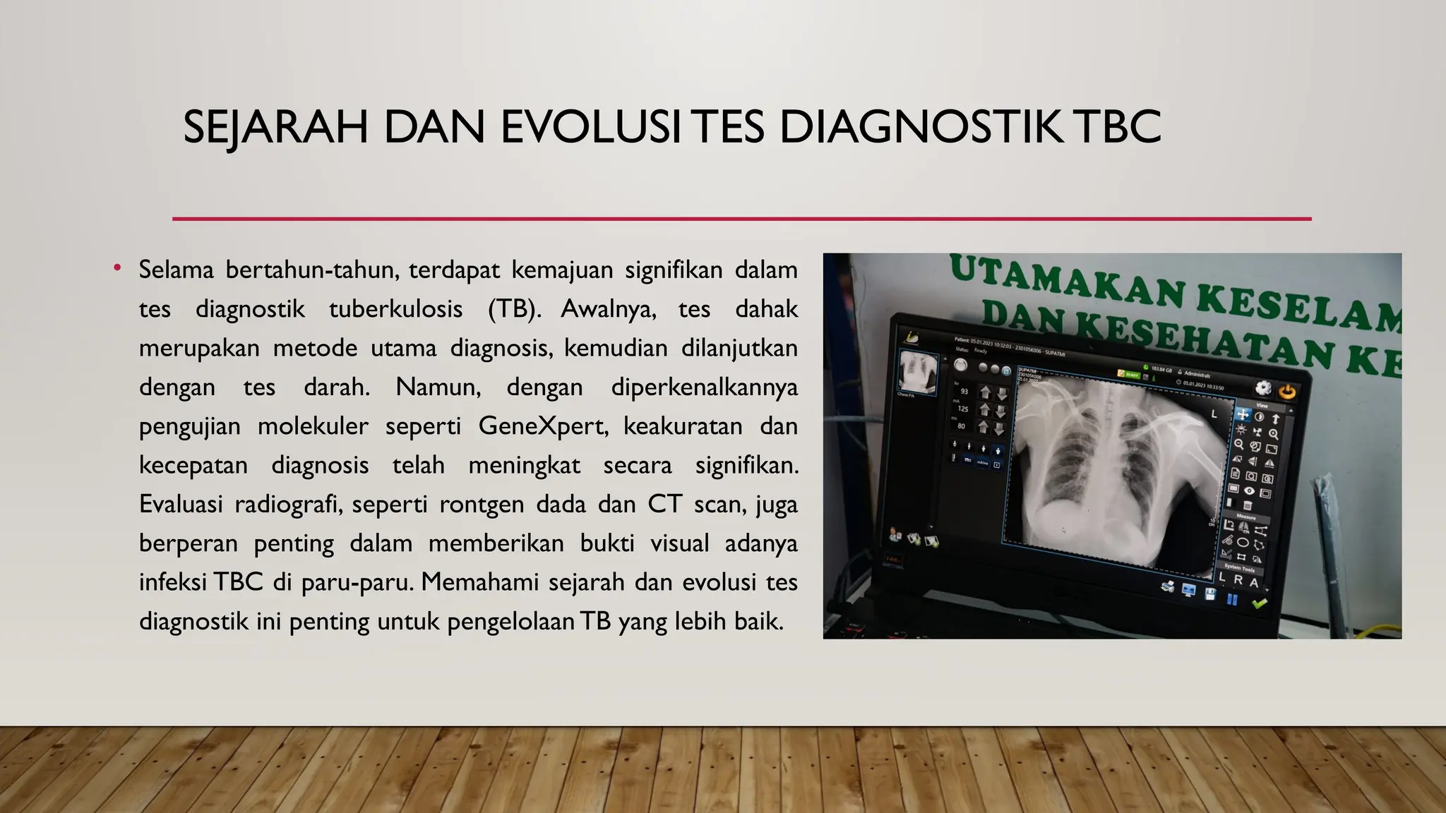 Pemeriksaan Laboratorium untuk Diagnosa Tuberculosis (TBC.pptx
