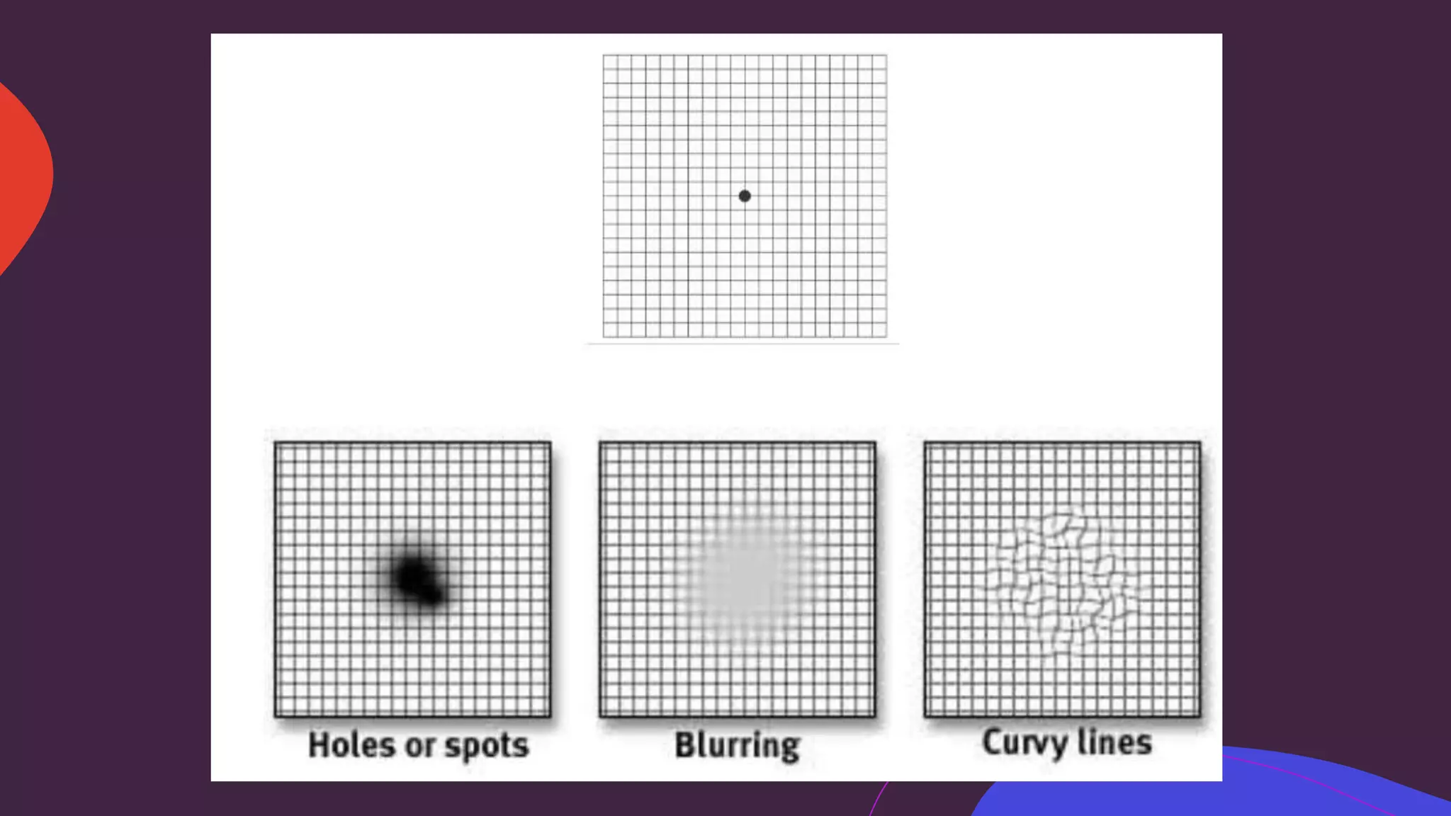 Pemeriksaan lapangan pandang (tes konfrontasi dan amsler | PPTX