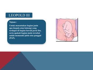 Pemeriksaan leopold | PPTX