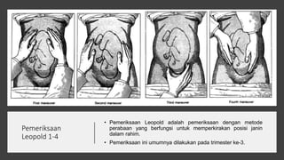 Pemeriksaan Leopold.pptx