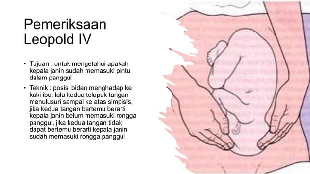 Pemeriksaan Leopold.pptx