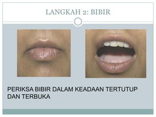 Pemeriksaan mulut | PPTX