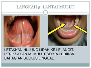 Pemeriksaan mulut | PPTX