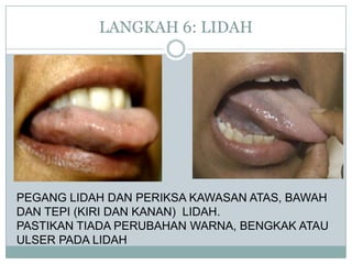 Pemeriksaan mulut | PPTX