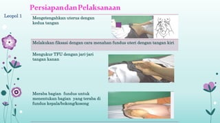 Pemeriksaan Palpasi leopold Pada Ibu Hamil | PPTX