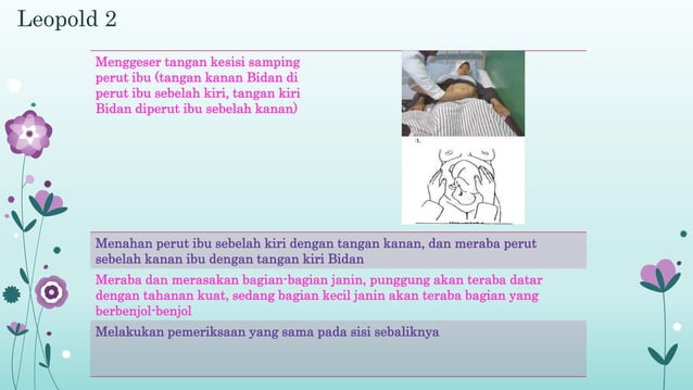Pemeriksaan Palpasi leopold Pada Ibu Hamil | PPTX