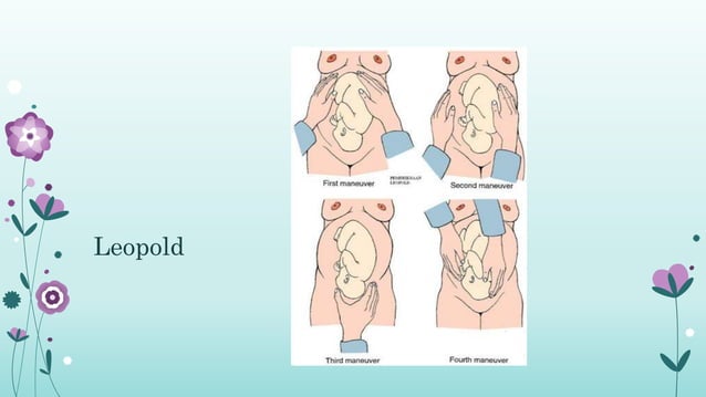 Pemeriksaan Palpasi leopold Pada Ibu Hamil | PPTX