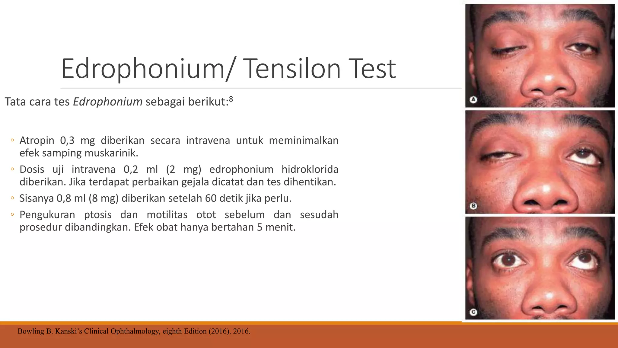 Pemeriksaan Palpebra.pptx