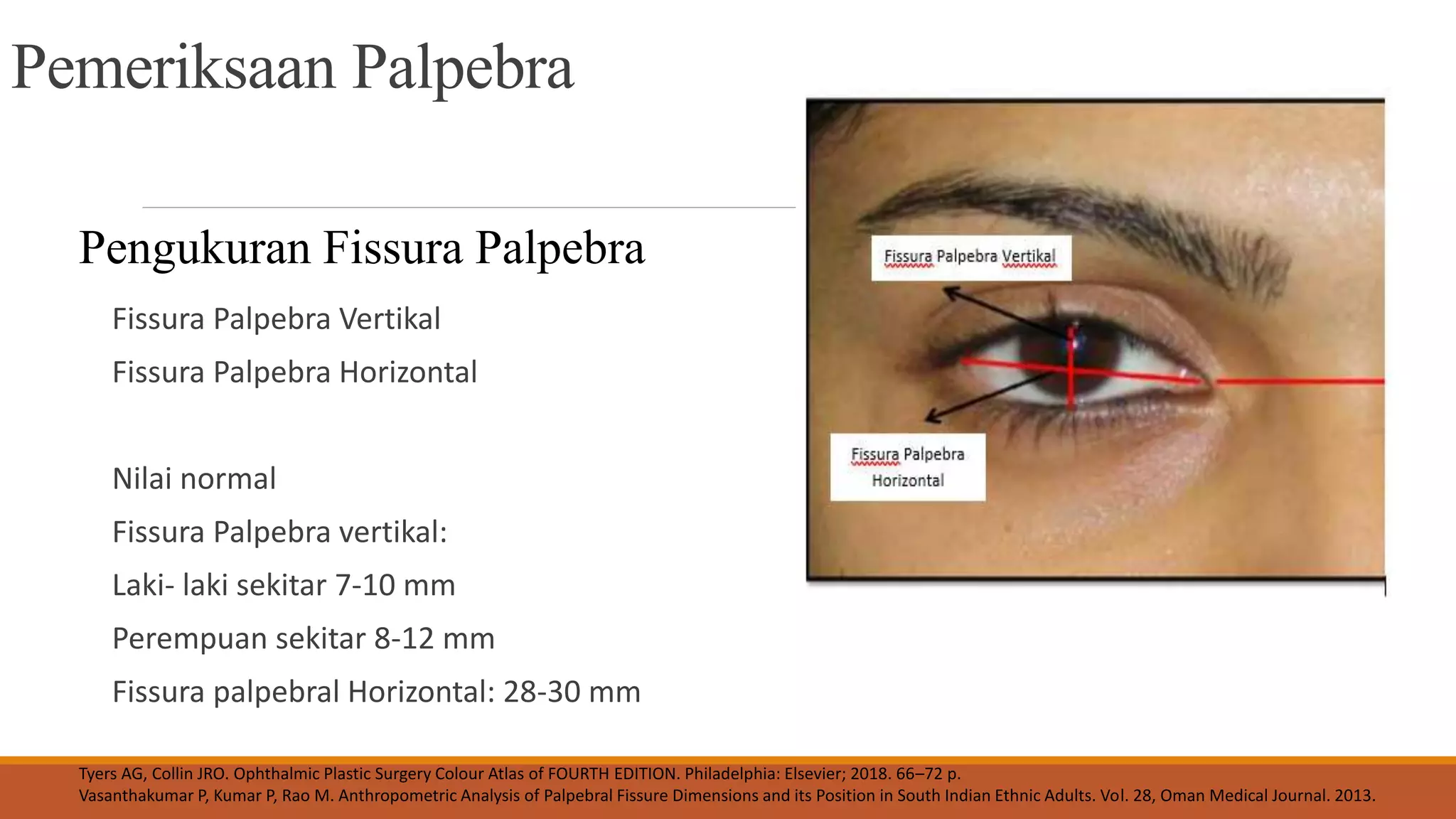 Pemeriksaan Palpebra.pptx