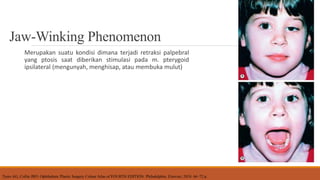 Pemeriksaan Palpebra.pptx