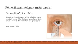 Pemeriksaan Palpebra.pptx