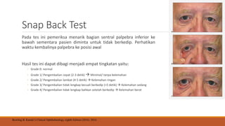 Pemeriksaan Palpebra.pptx