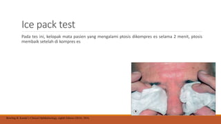 Pemeriksaan Palpebra.pptx