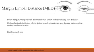 Pemeriksaan Palpebra.pptx