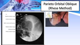 Pemeriksaan Penunjang Maxillofasial.pptx