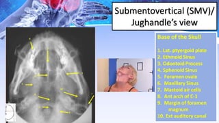 Pemeriksaan Penunjang Maxillofasial.pptx
