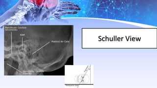 Pemeriksaan Penunjang Maxillofasial.pptx
