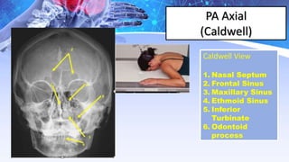 Pemeriksaan Penunjang Maxillofasial.pptx