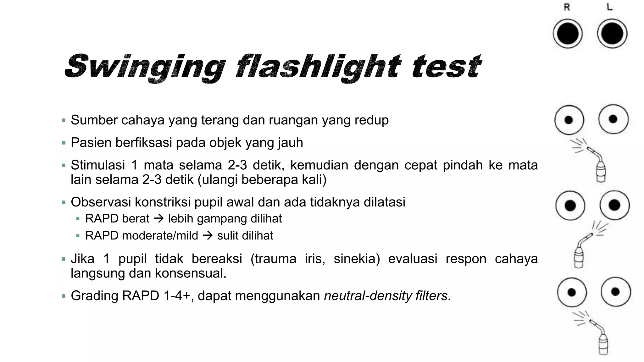 Pemeriksaan Pupil, Gerak Bola Mata, Saraf.pptx