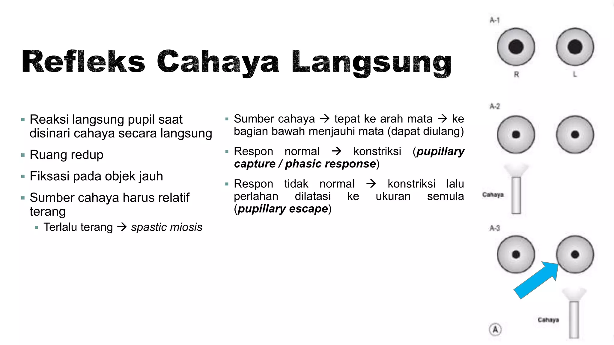 Pemeriksaan Pupil, Gerak Bola Mata, Saraf.pptx