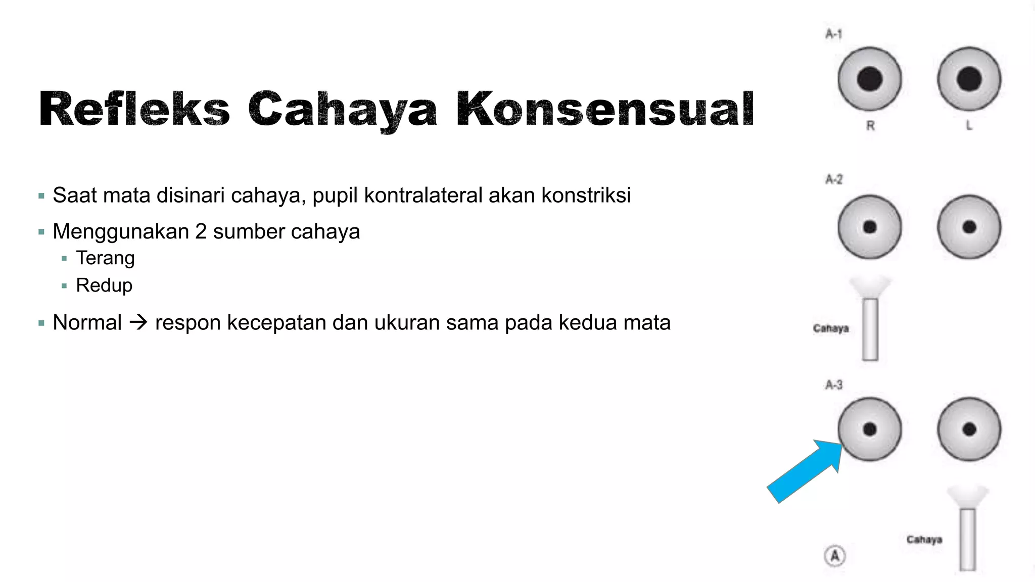 Pemeriksaan Pupil, Gerak Bola Mata, Saraf.pptx