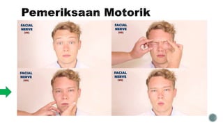 Pemeriksaan Pupil, Gerak Bola Mata, Saraf.pptx