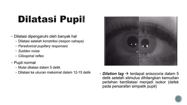 Pemeriksaan Pupil, Gerak Bola Mata, Saraf.pptx