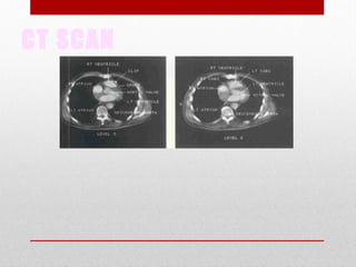 PEMERIKSAAN RADIOGRAFI DADA (CHEST RADIOGRAPHY) | PPT