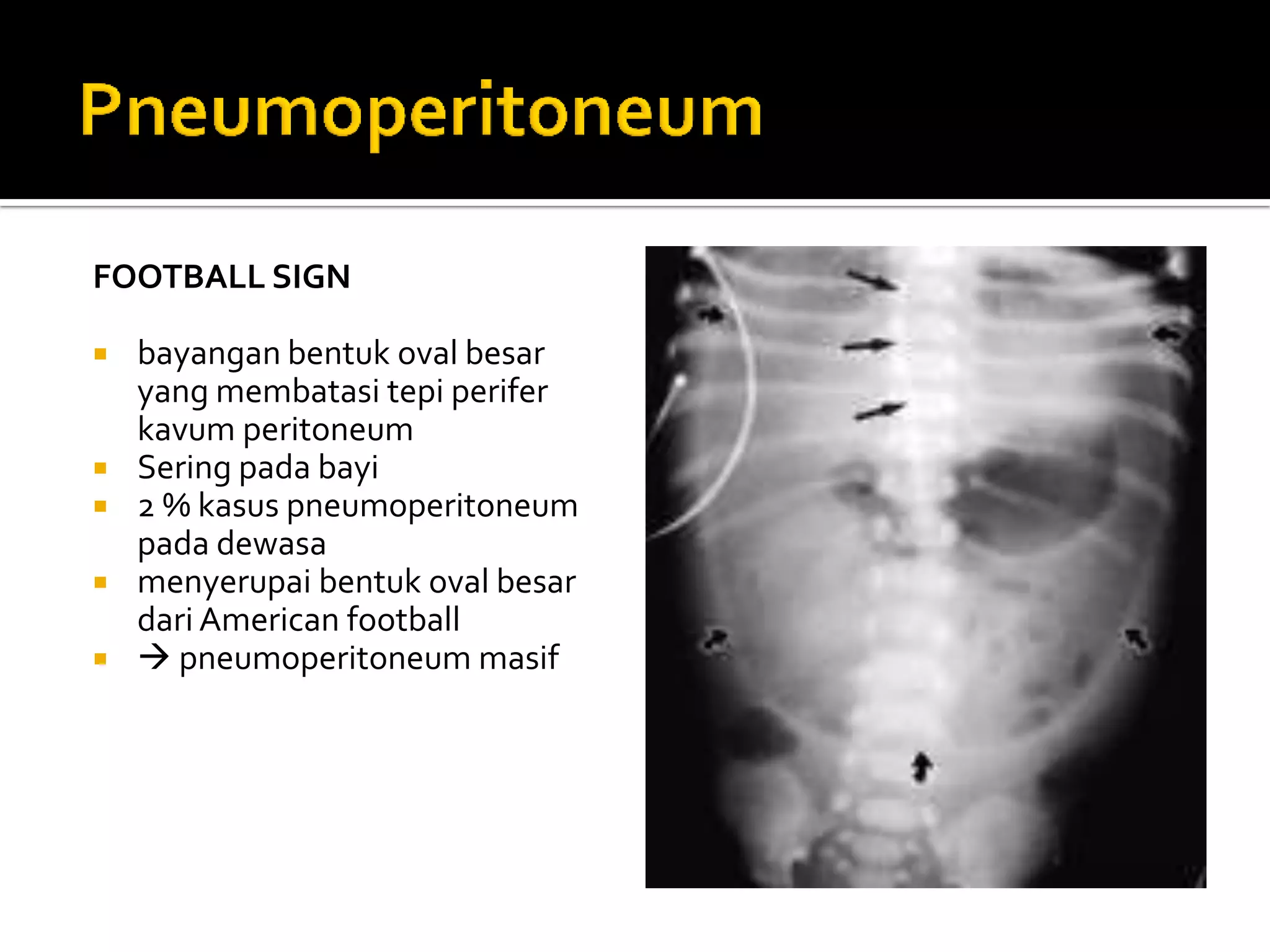Pemeriksaan Radiologi Tr. Digestivus - Kuliah .pdf