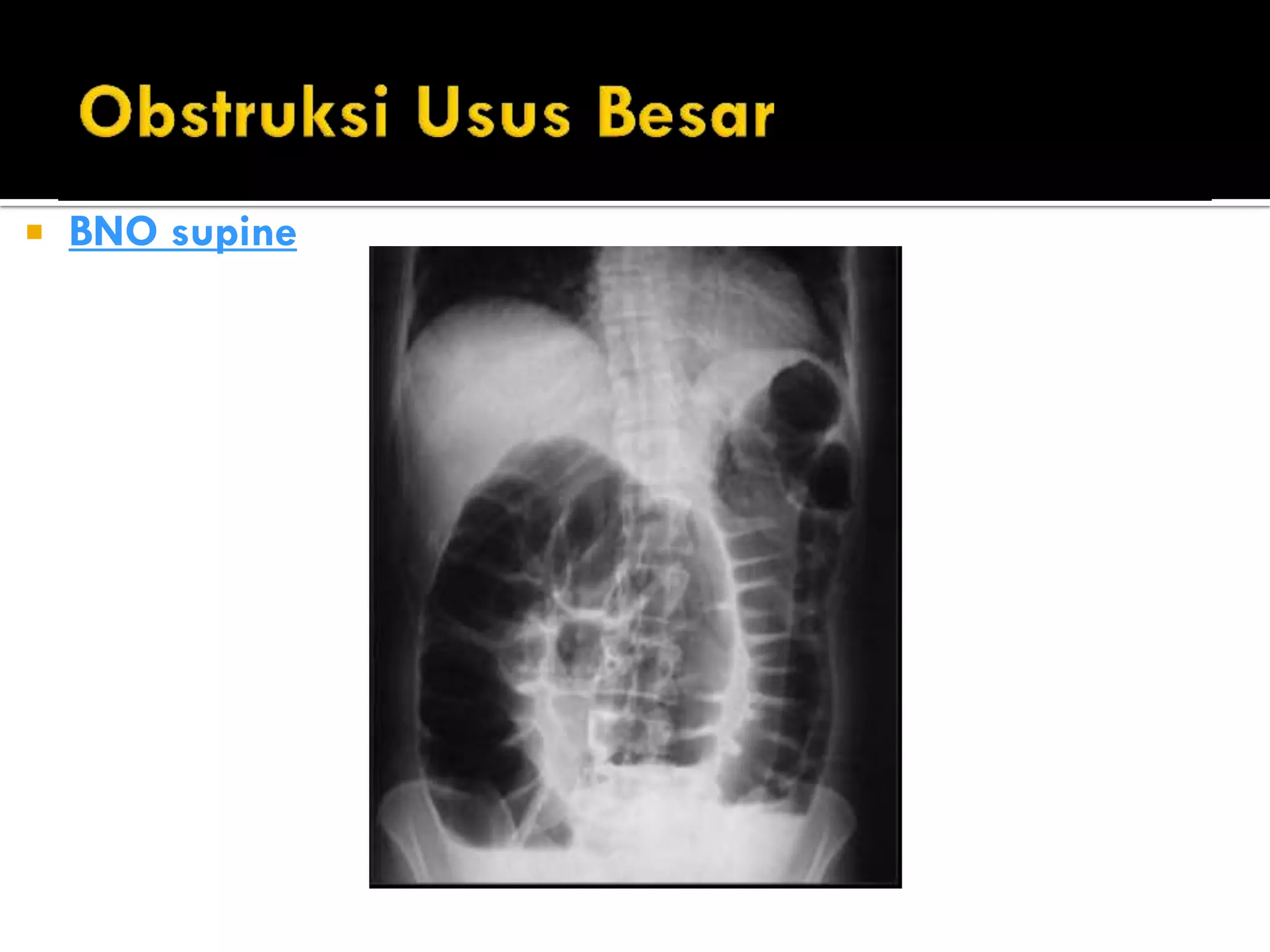 Pemeriksaan Radiologi Tr. Digestivus - Kuliah .pdf