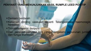 PEMERIKSAAN RUMPLE LEEDE.pptx