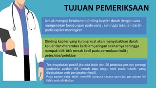 PEMERIKSAAN RUMPLE LEEDE.pptx