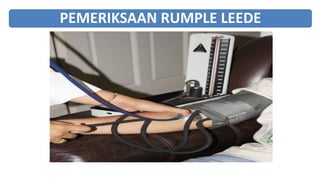 PEMERIKSAAN RUMPLE LEEDE.pptx