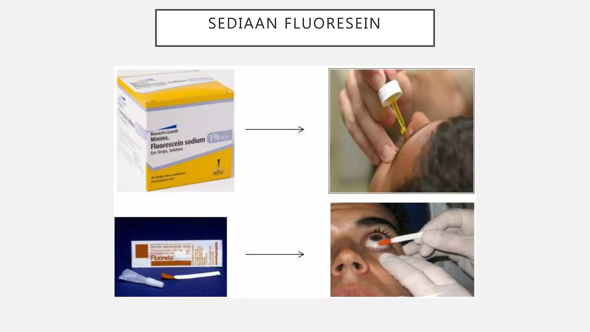 Pemeriksaan sensibilitas kornea dan inspeksi kornea fluoresein | PPT
