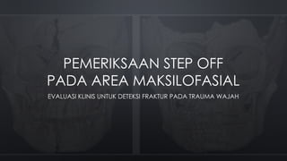 Pemeriksaan Step Off pada Area Maksilofasial.pptx
