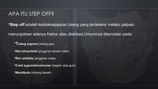 Pemeriksaan Step Off pada Area Maksilofasial.pptx