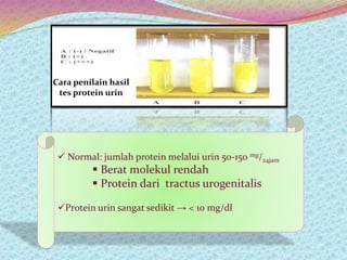 Pemeriksaan urin rutin | PPTX